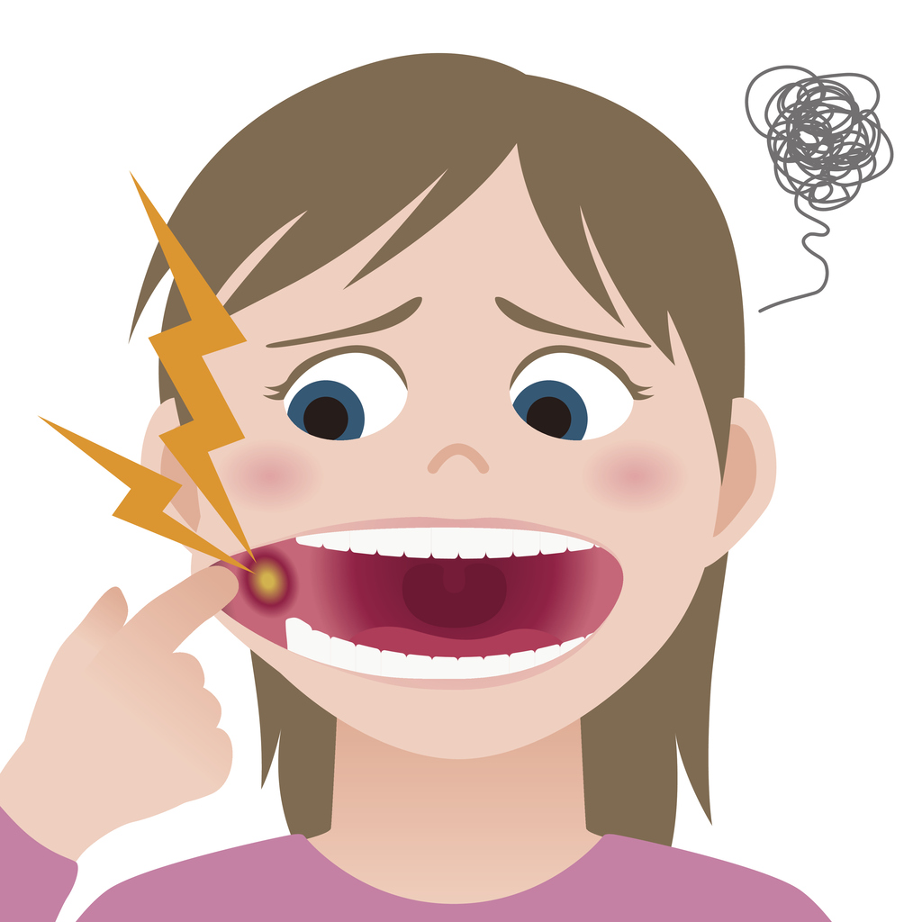 stomatitis, mouth ulcer, inflammation of the oral mucosa, image ...